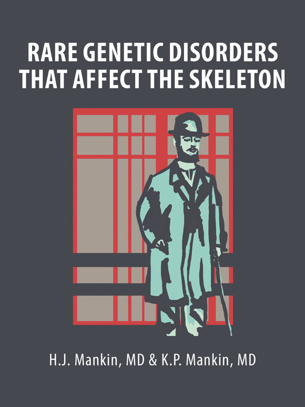 Rare Genetic Disorders That Affect The Skeleton Fable Stories For Everyone